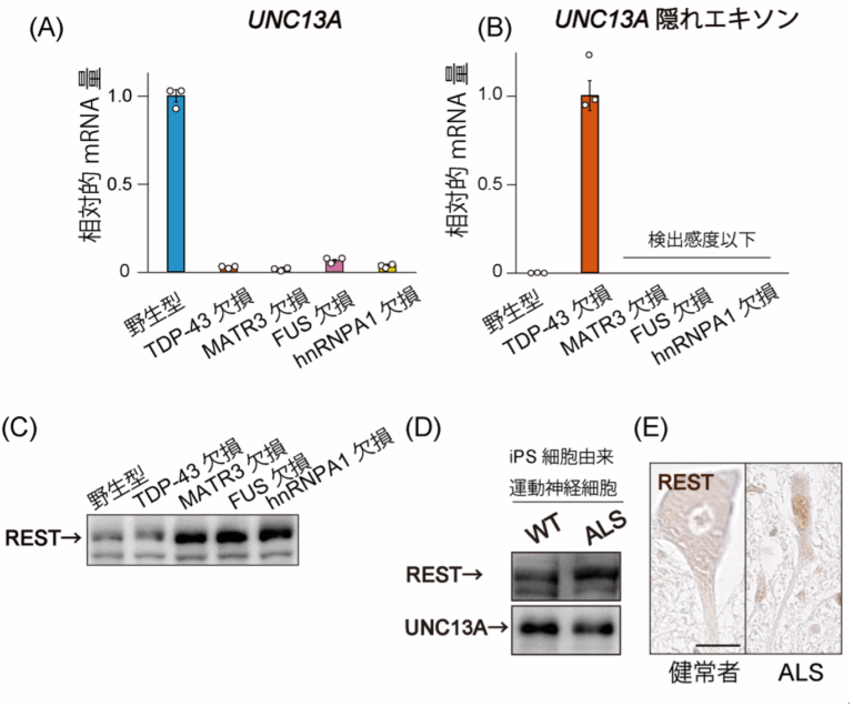 ALSの異なる原因が共通の遺伝子「UNC13A」の発現異常に収束 病気の全貌解明へ新知見 | NEWSROOM | 東北大学医療系メディア〈LIFE〉